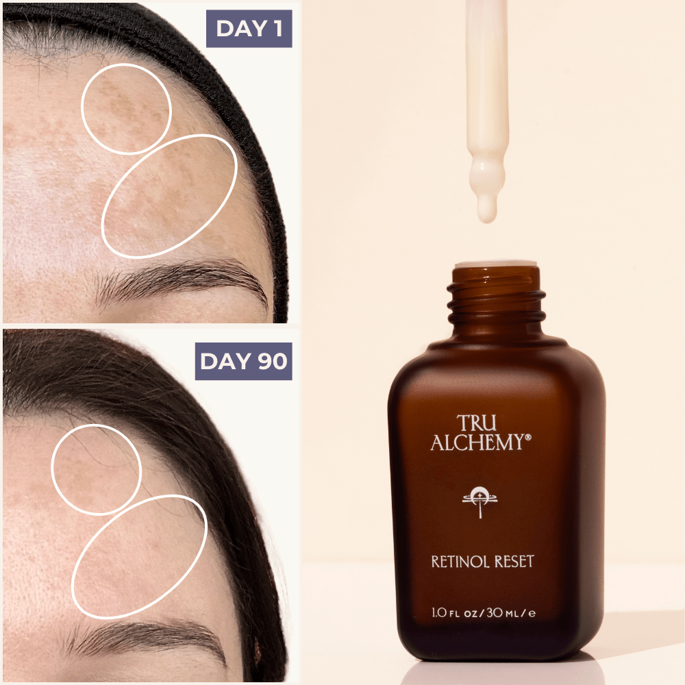 Retinol Reset: Advanced Retinol Skin Renewal Serum – Tru Alchemy