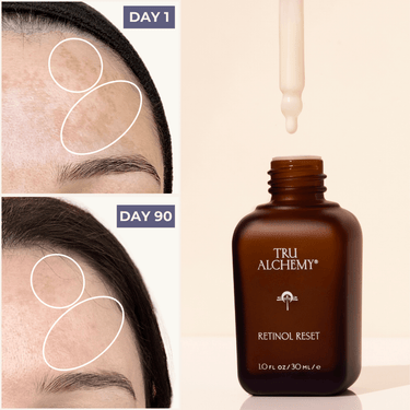 Retinol Reset – Tru Alchemy